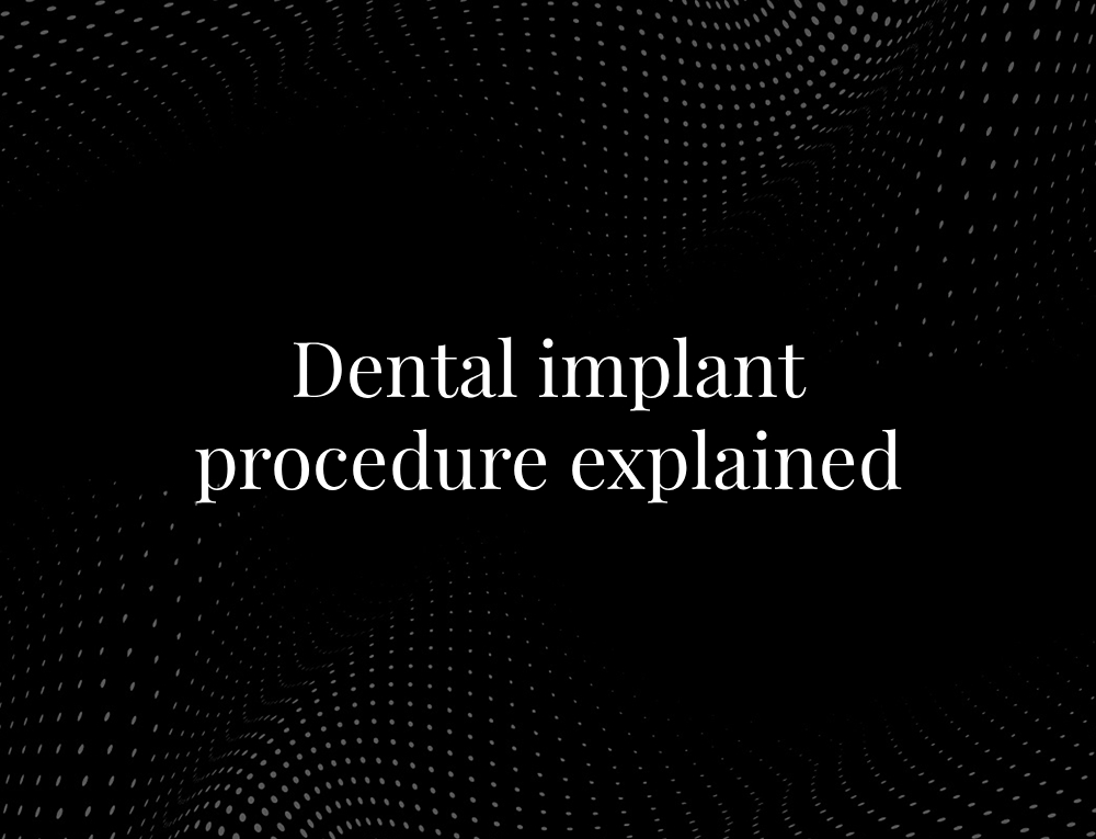 Dental Implant Procedure Explained | Dentzz Dental